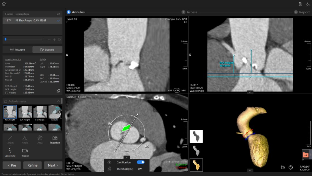 博动医疗科技—技术赋能医学，守护生命健康 - 博动医疗科技