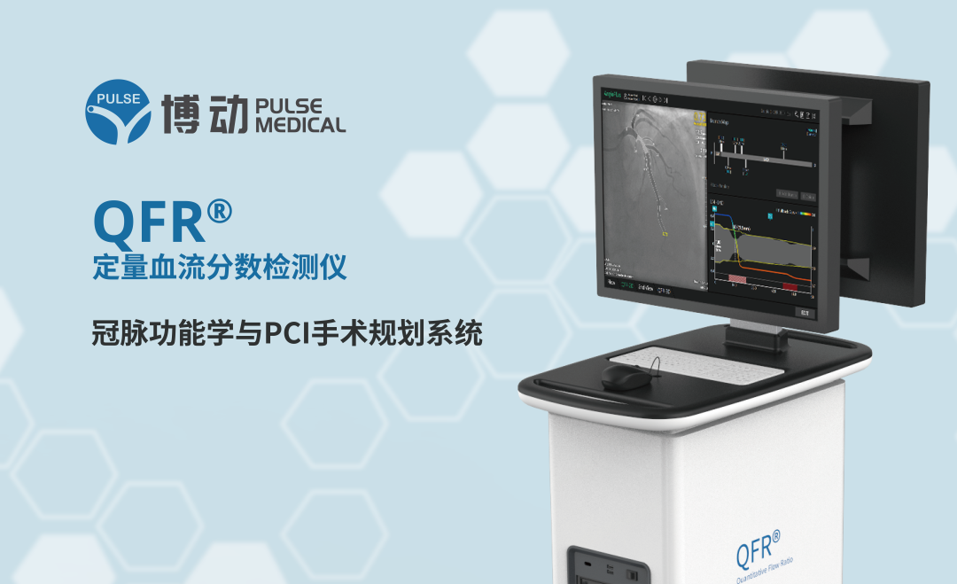 优势技术 | 我院心血管内科采取无创功能学QFR新技术精准指导冠脉介入手术 - 博动医疗